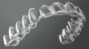 Invisalign Dentist in Bronx, NY | Invisible Braces